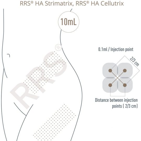 Acid hialuronic injectabil pentru fata, corp si par- RRS®